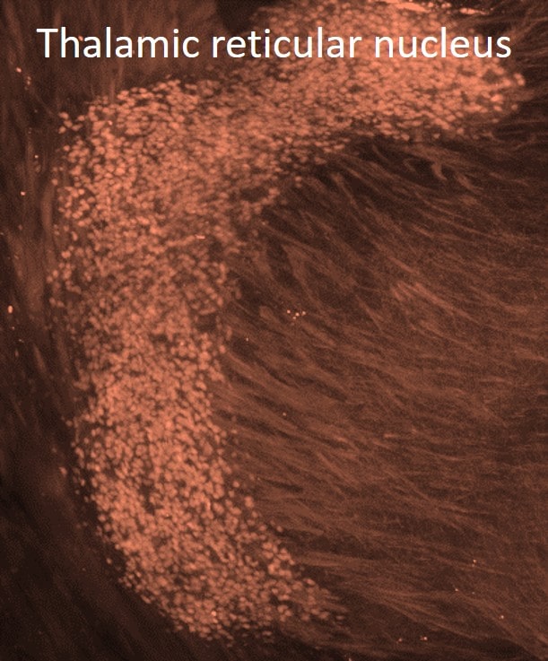 Parvalbumin Antibody (PA1-933)