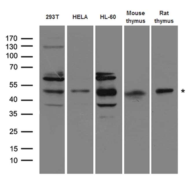 RAD52 Antibody (TA890144)