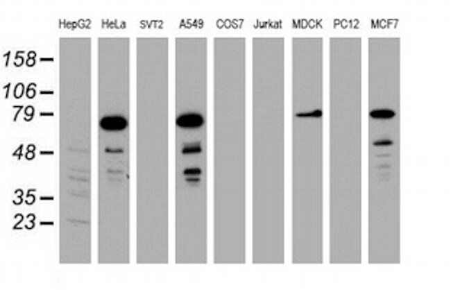 RIPK1 Antibody (TA800357)