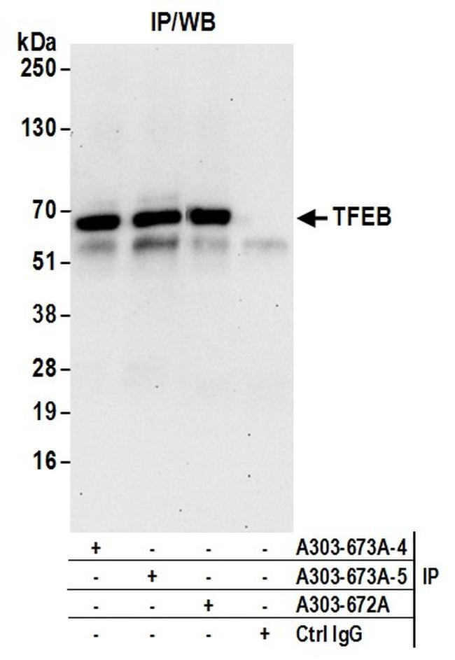 TFEB Antibody (A303-673A)