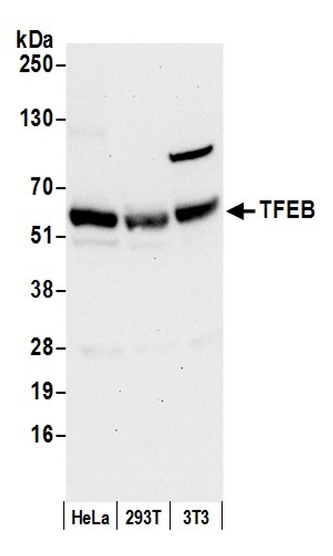 TFEB Antibody (A303-673A)