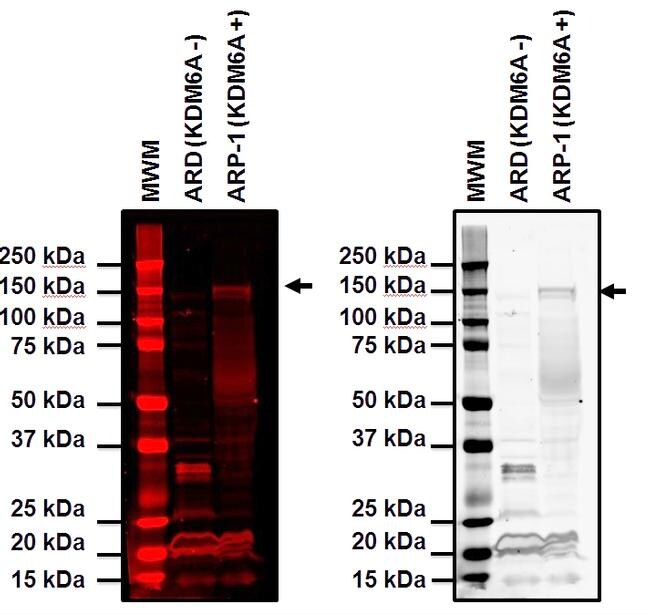 KDM6A Antibody (PA5-31828)