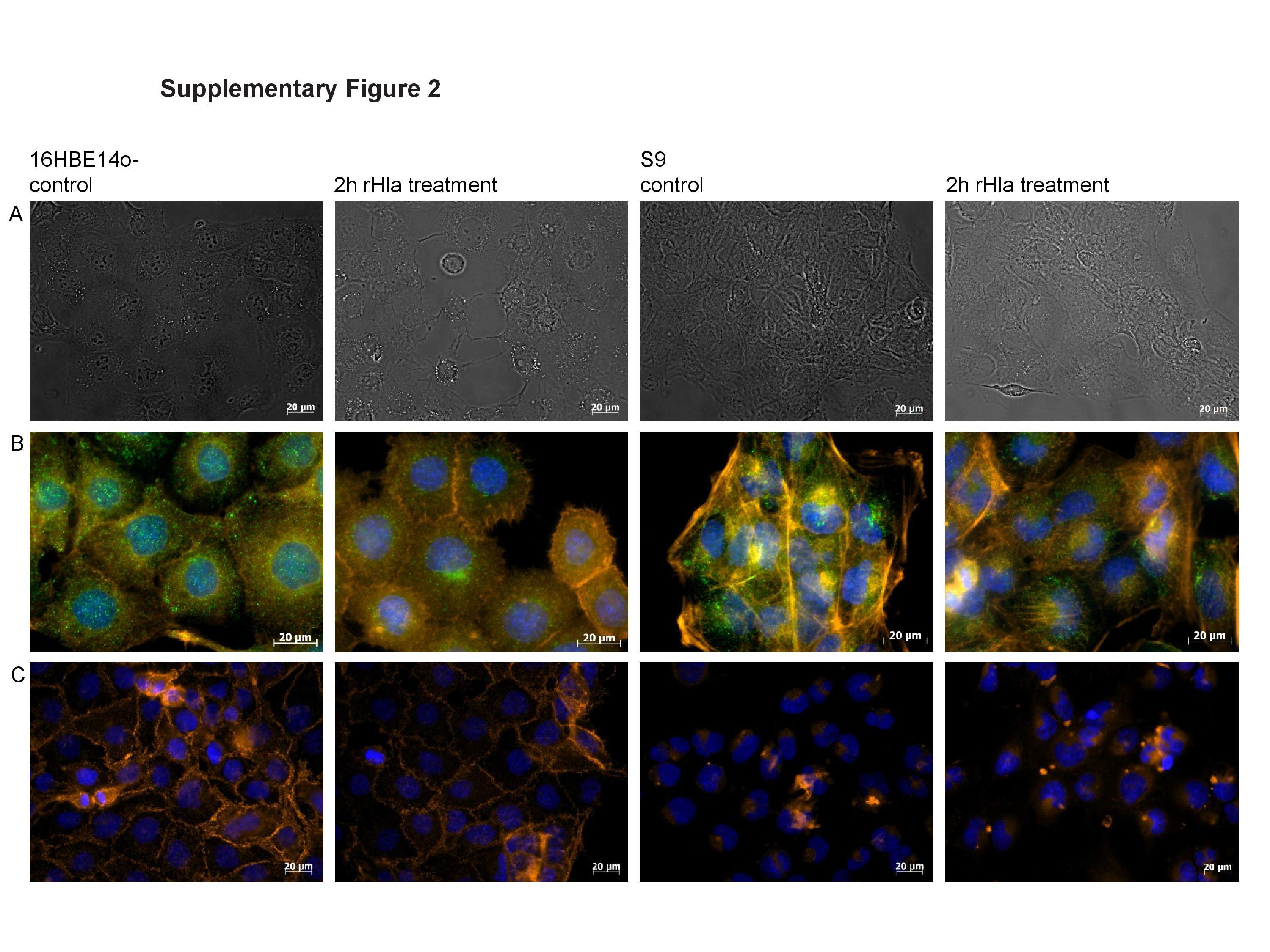 Vinculin Antibody (700062)