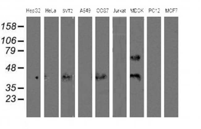 WWTR1 Antibody (TA503438)