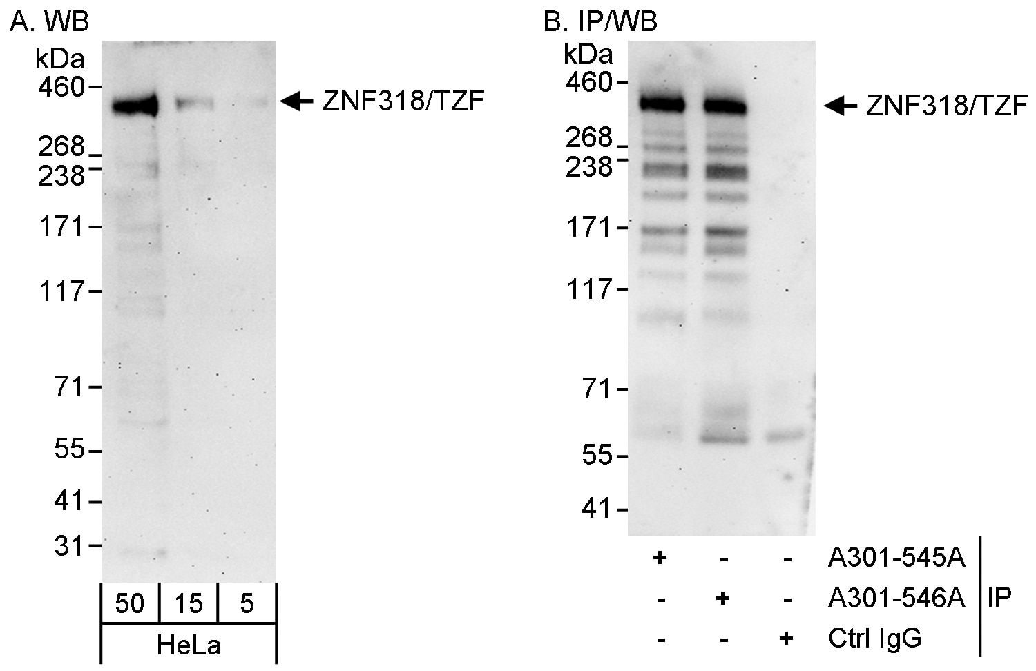 ZNF318/TZF Antibody (A301-546A)