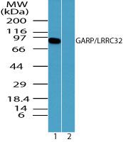 GARP Antibody (PA5-23301)