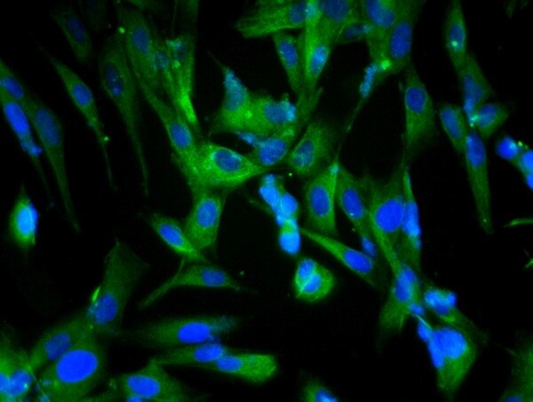 Beclin 1 Antibody (BS-1353R)