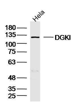 DGKI Antibody (BS-14299R)