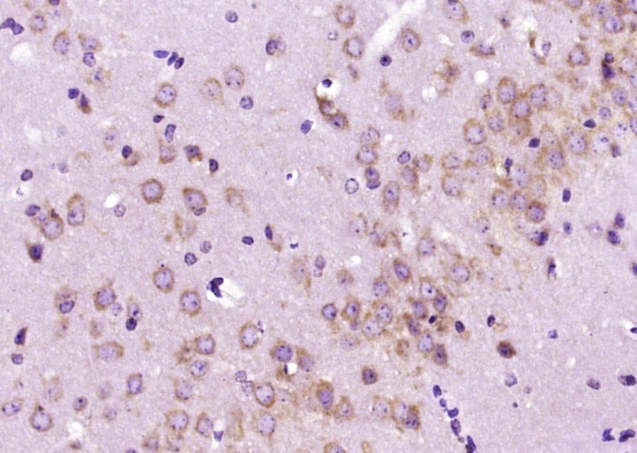 DAT/Dopamine transporter Antibody (BS-1714R)