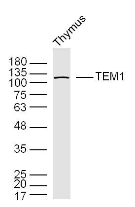 TEM1/CD248 Antibody (BS-2101R)