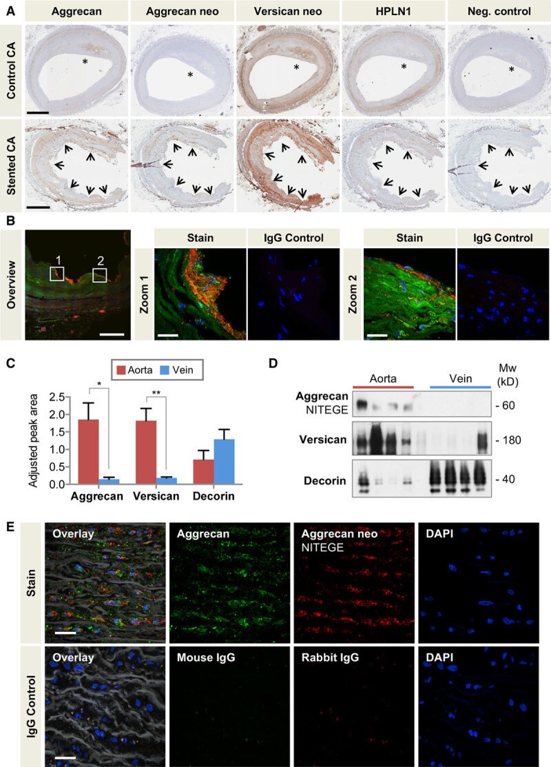 Aggrecan Neo Antibody (PA1-1746)