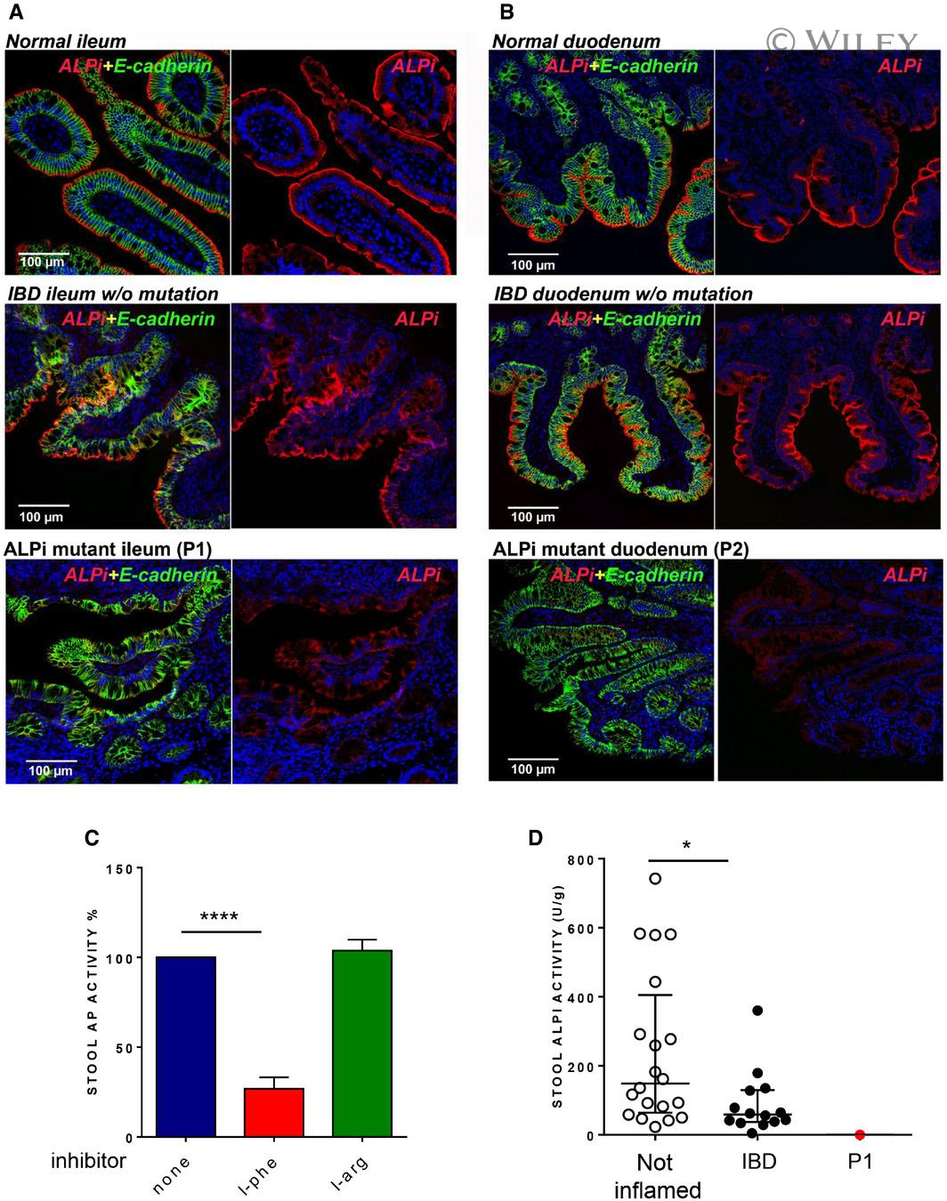 Intestinal Alkaline Phosphatase Antibody (PA5-22210)