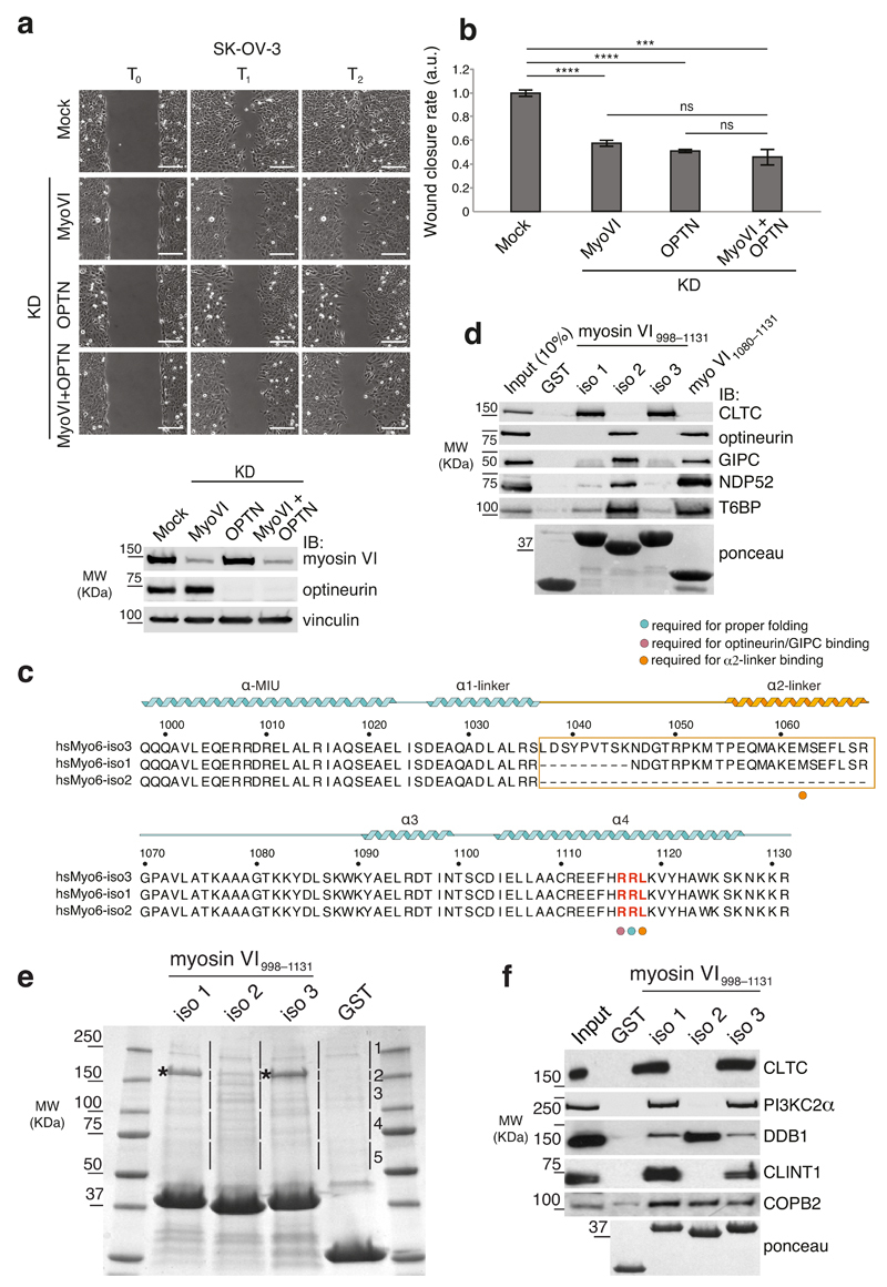 Clathrin Heavy Chain Antibody (MA1-065)
