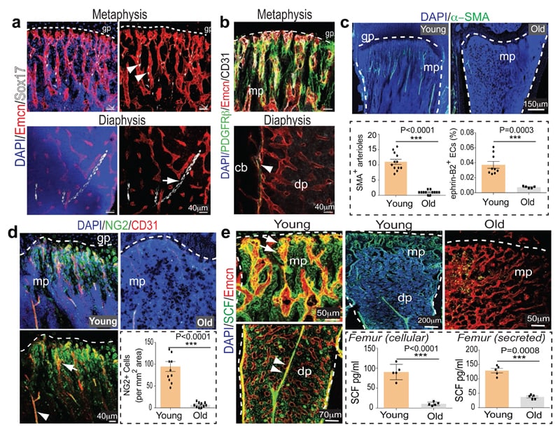 CD140b (PDGFRB) Antibody (14-1402-82)