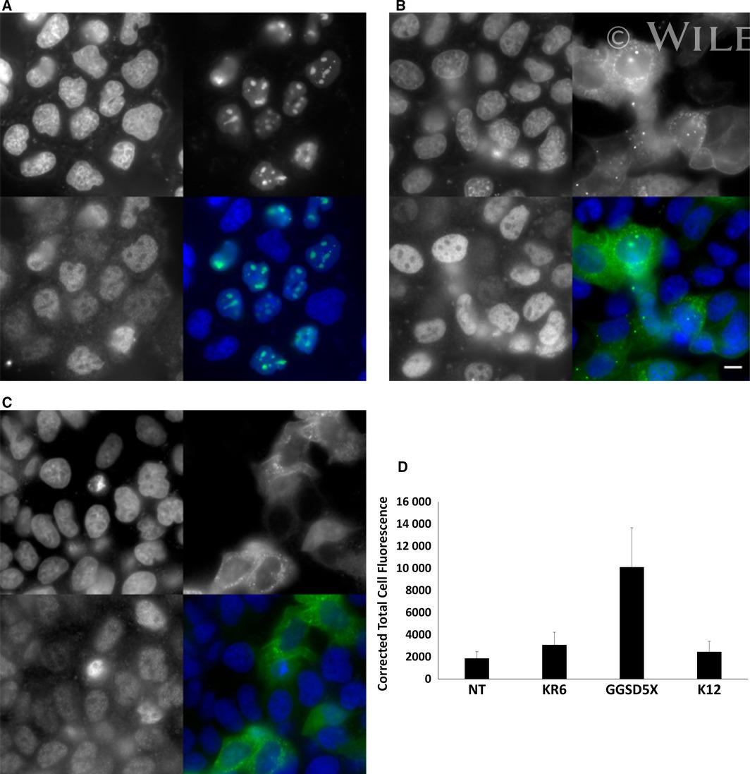 Phospho-CREB/ATF1 (Ser133, Ser63) Antibody (MA1-114)