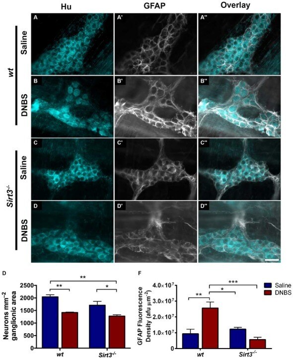 HuC/HuD Antibody, Biotin (A-21272)