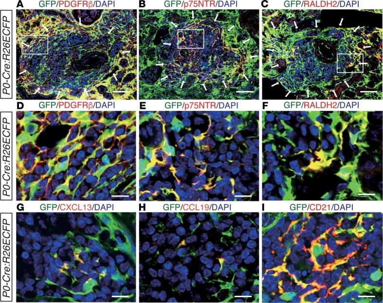 CD140b (PDGFRB) Antibody (14-1402-82)