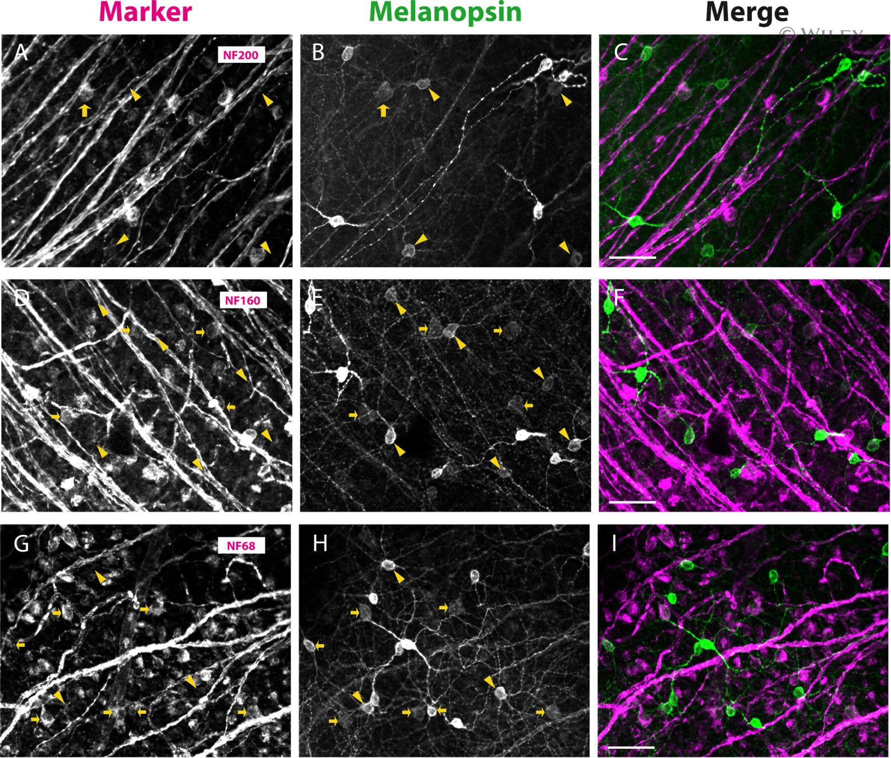Opsin 4 Antibody (PA1-781)
