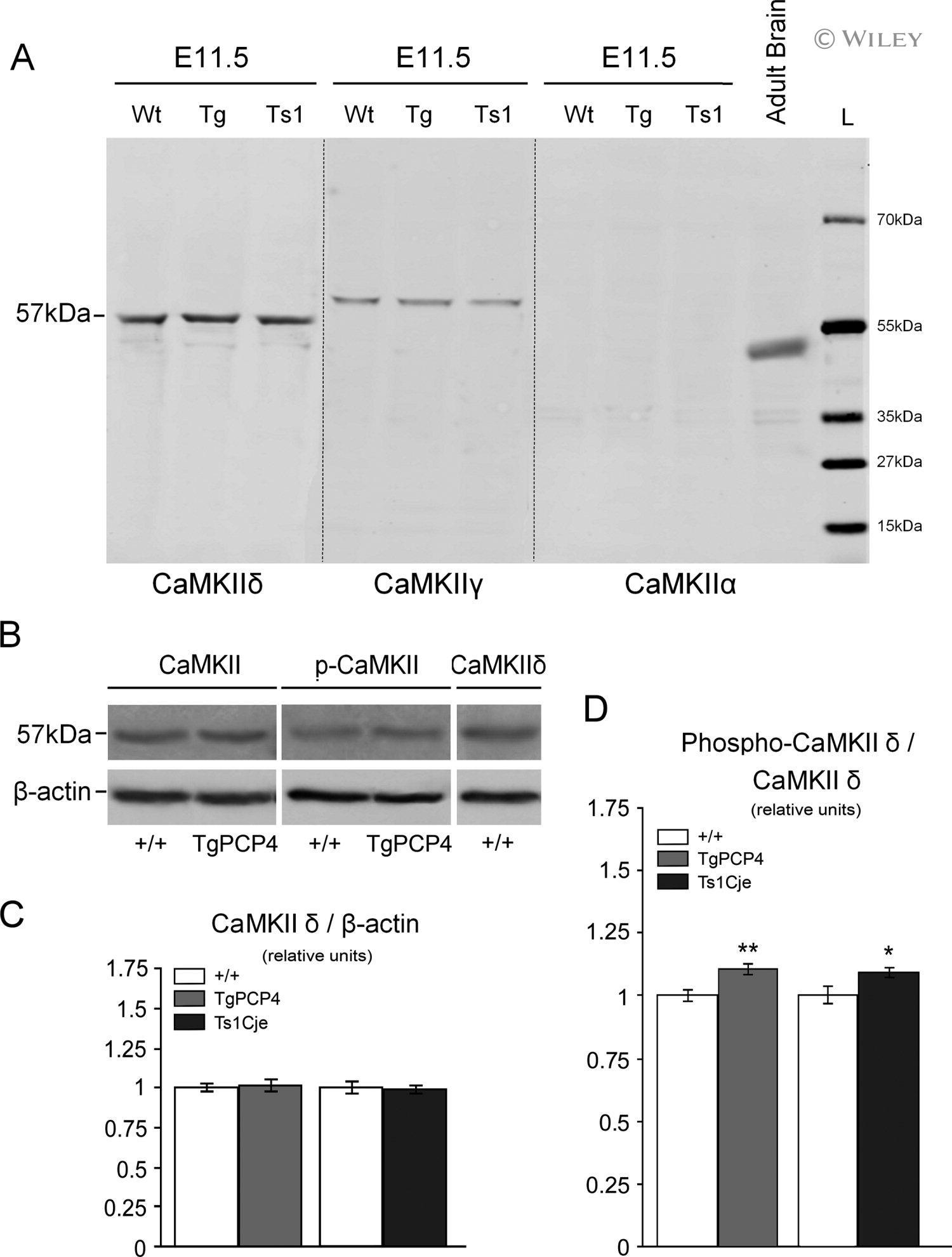 CaMKII alpha Antibody (MA1-048)