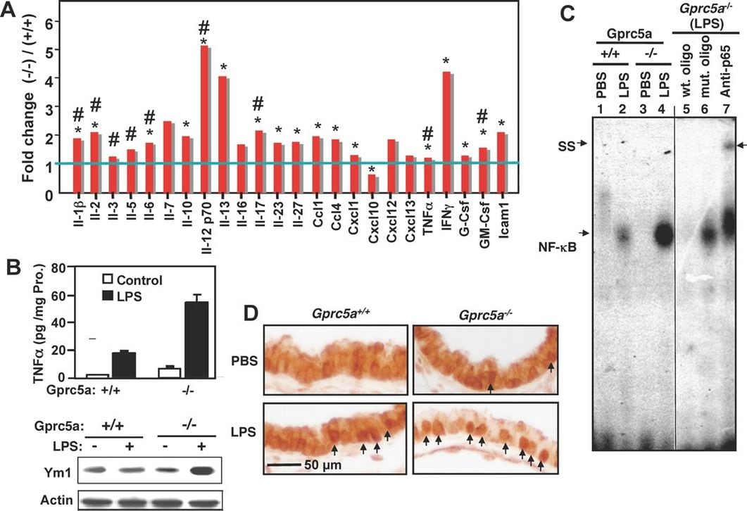 NFkB p65 Antibody (14-6731-81)