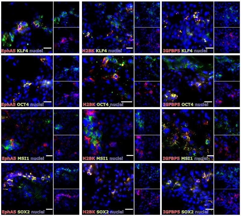 KLF4 Antibody (MA5-15672)