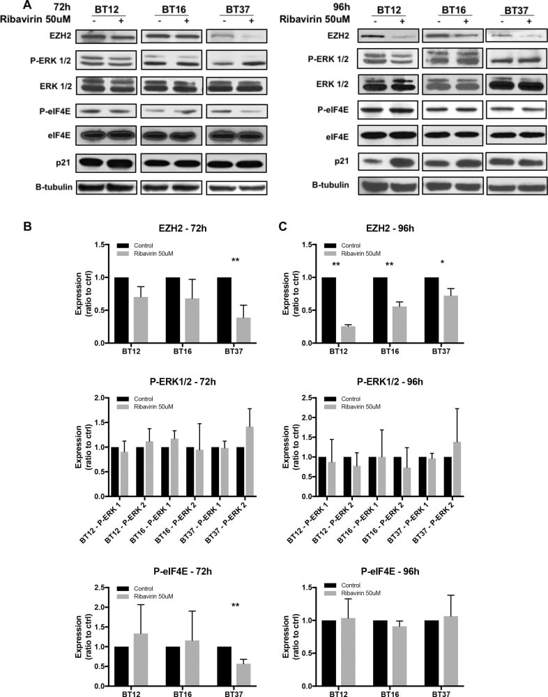 EZH2 Antibody (MA5-18108)