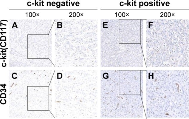 CD34 Antibody (MA1-10202)