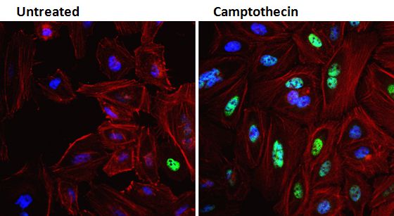Phospho-CREB/ATF1 (Ser133, Ser63) Antibody (MA1-114)