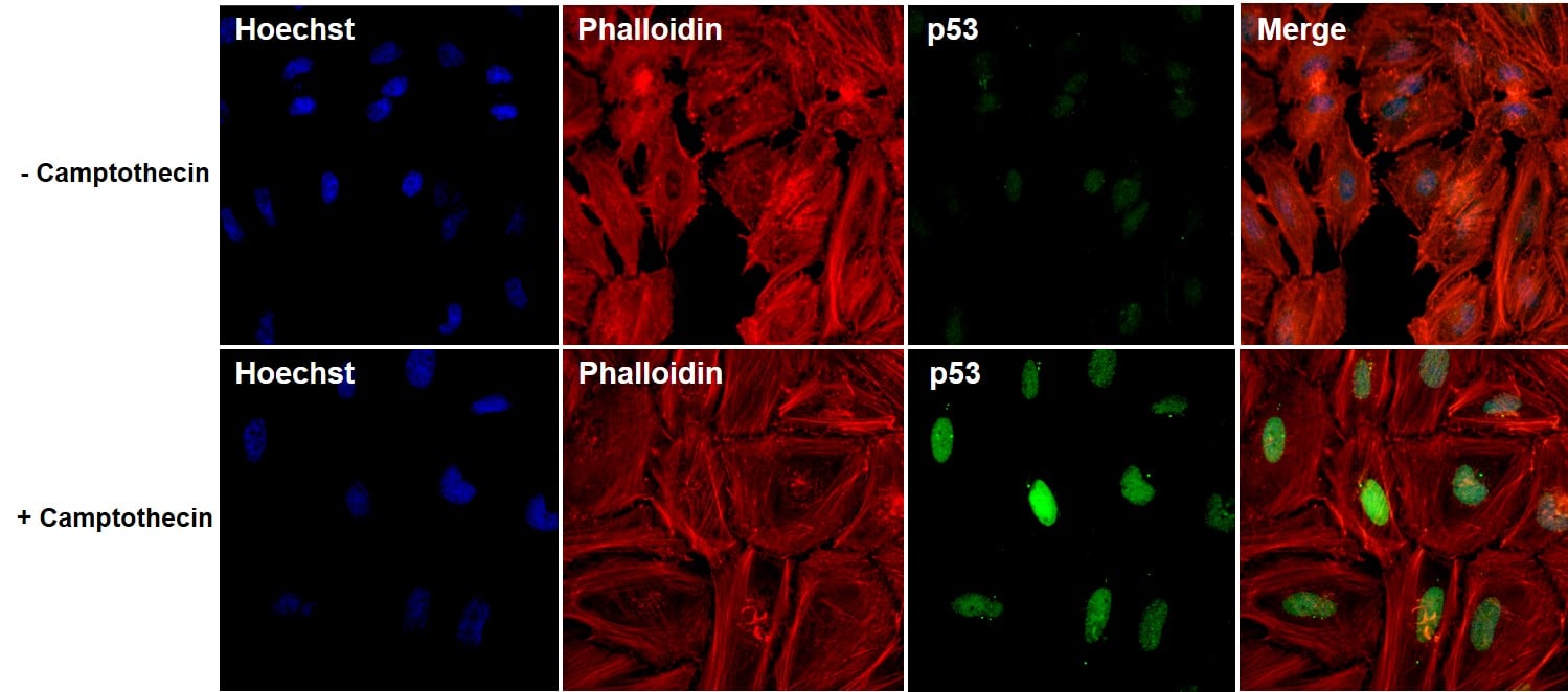 p53 Antibody (MA5-12571)