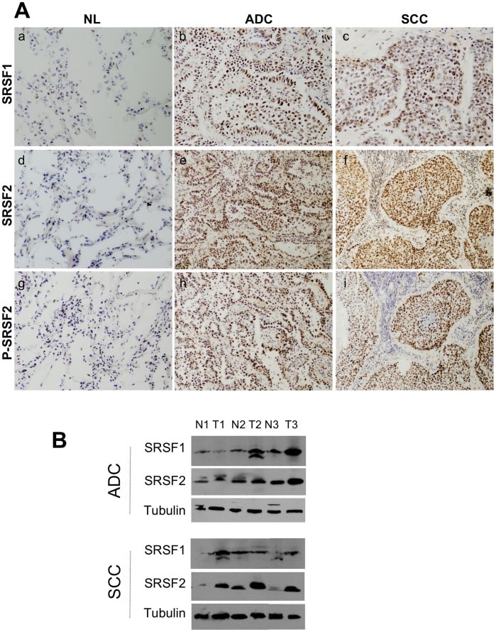 SRSF1 Antibody (32-4500)