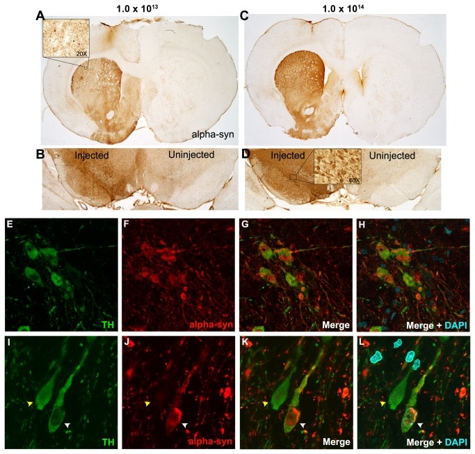 alpha Synuclein Antibody (AHB0261)