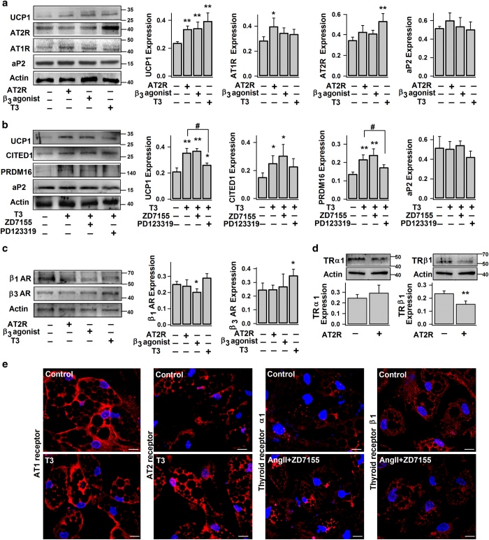 PRDM16 Antibody (PA5-20872)