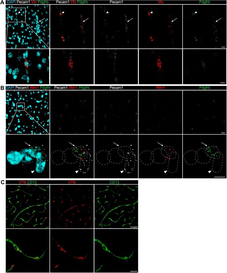 CD140b (PDGFRB) Antibody (14-1402-82)