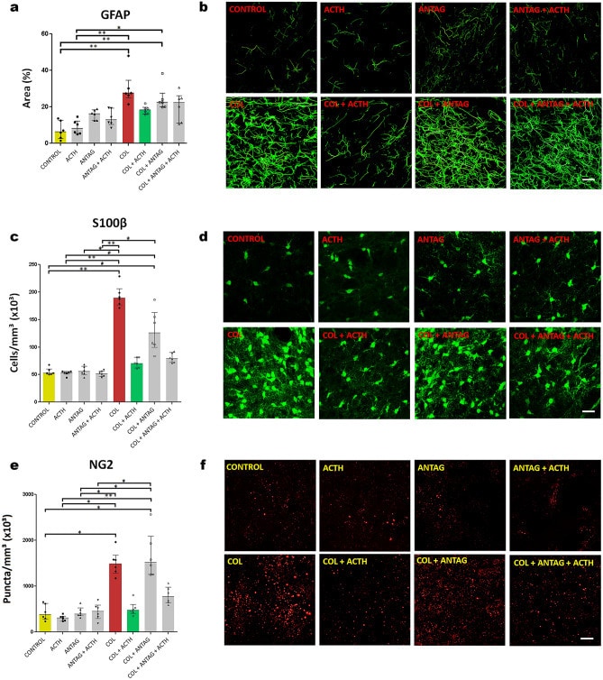 GFAP Antibody, Alexa Fluor™ 488 (53-9892-82)