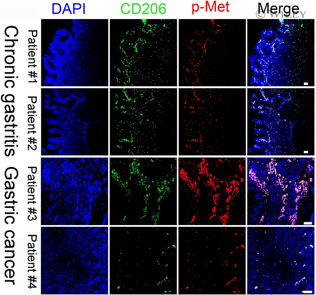 CD206 (MMR) Antibody, Alexa Fluor™ 488 (53-2069-42)