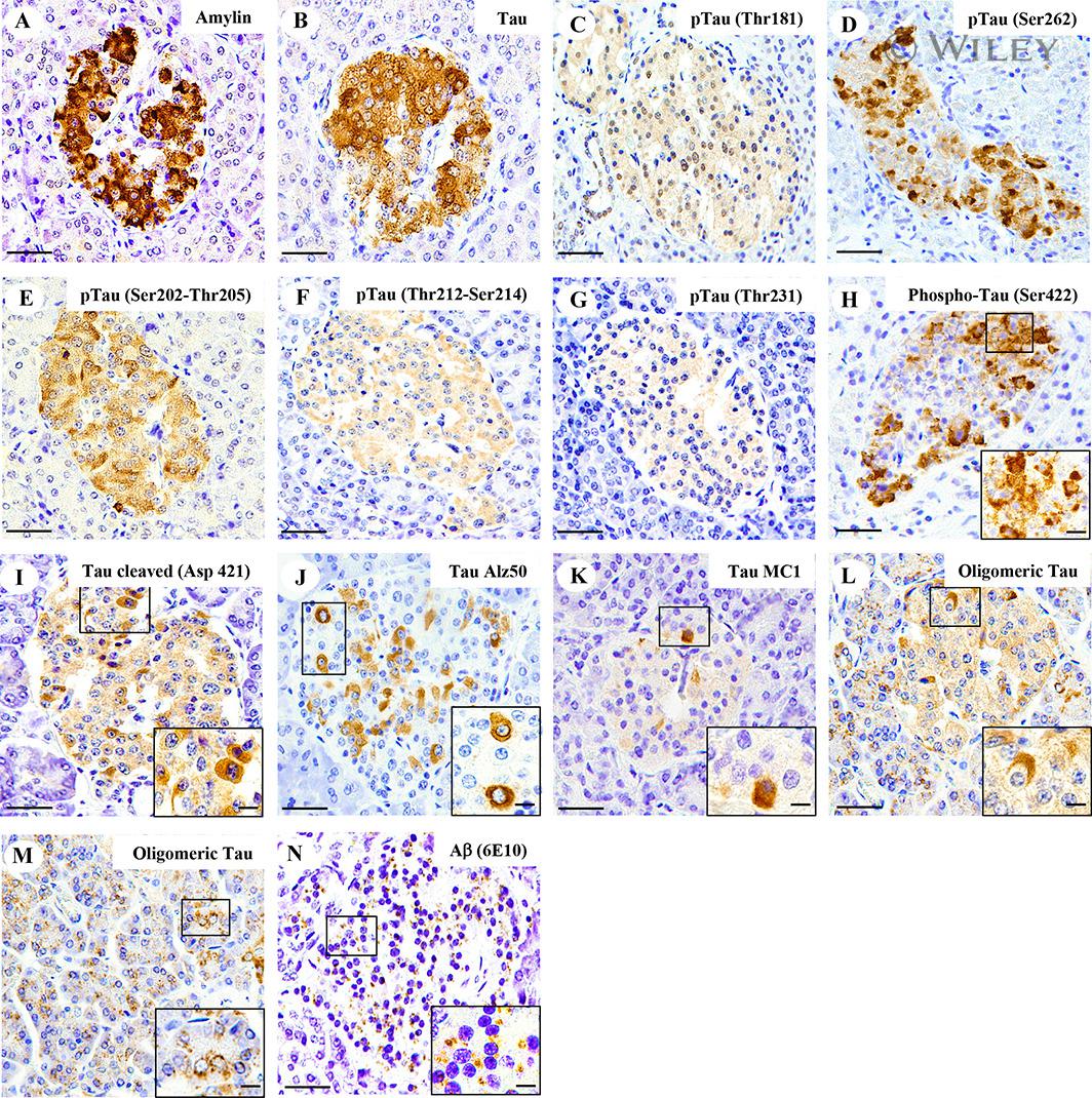 Phospho-Tau (Ser262) Antibody (44-750G)
