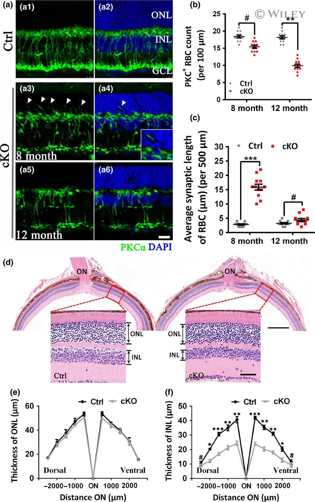 PKC alpha Antibody (MA1-157)