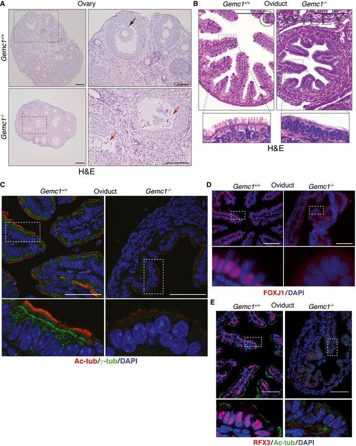 FOXJ1 Antibody (14-9965-82)