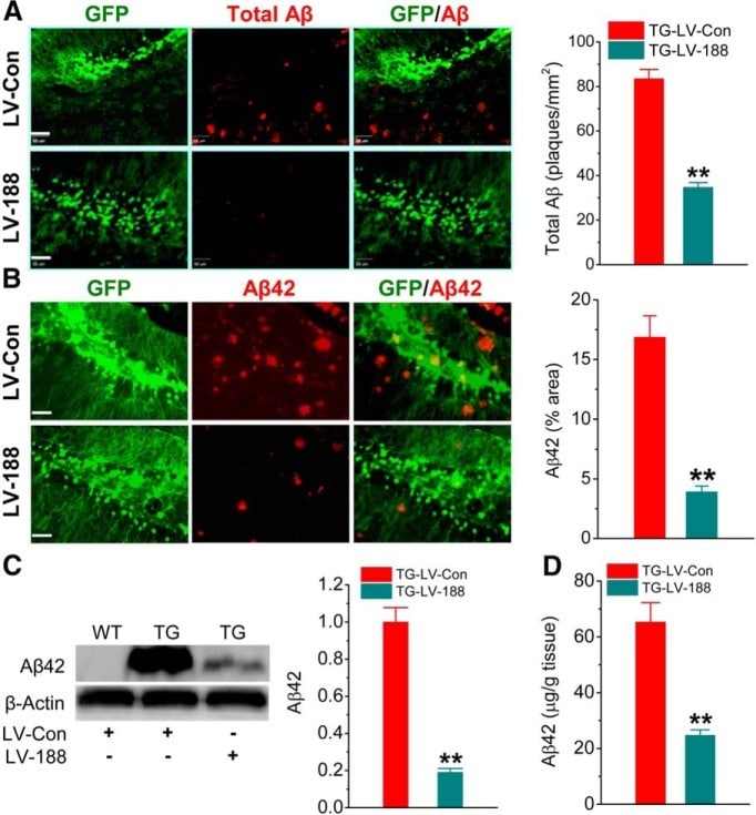 beta Amyloid (1-42) Antibody (44-344)