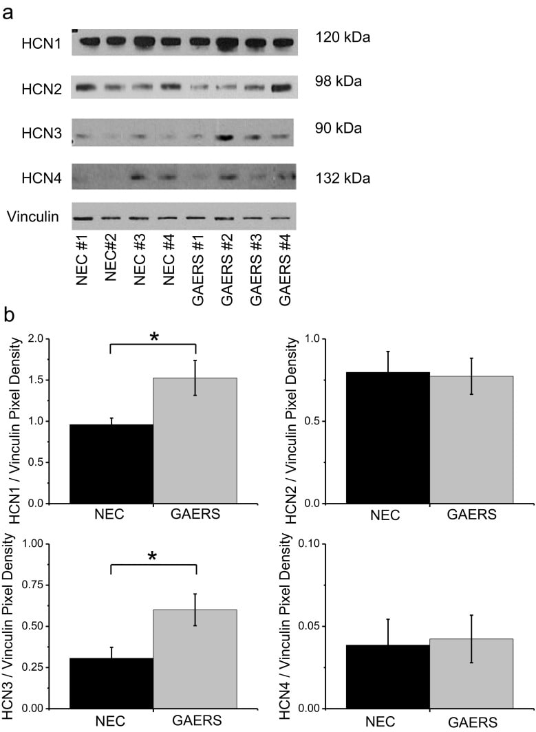 HCN4 Antibody (MA3-903)