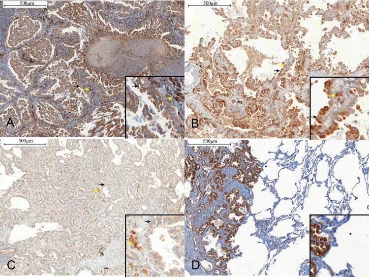 MMP13 Antibody (MA5-14238)