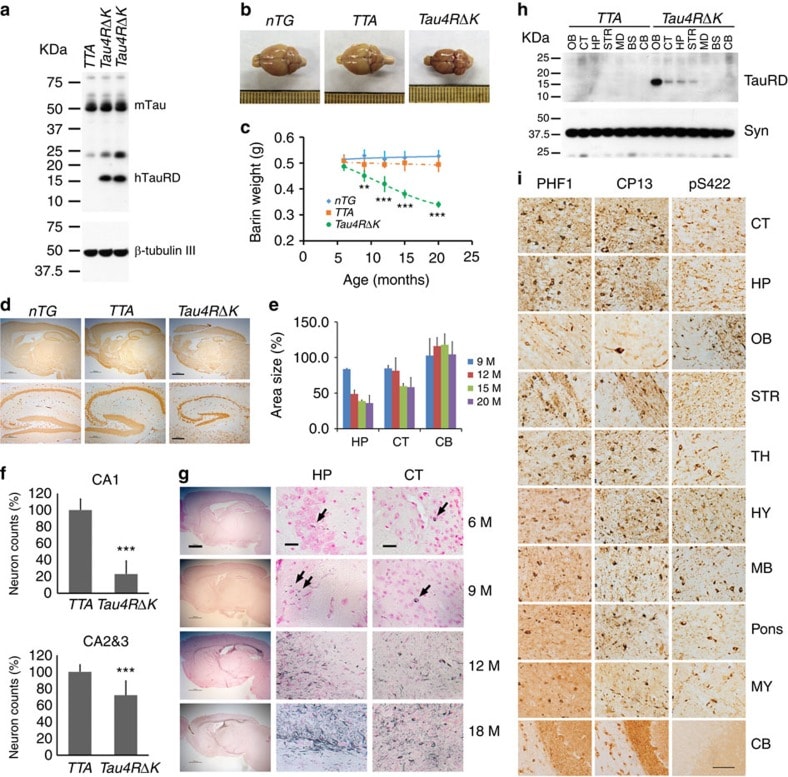 Phospho-Tau (Thr231) Antibody (44-746G)