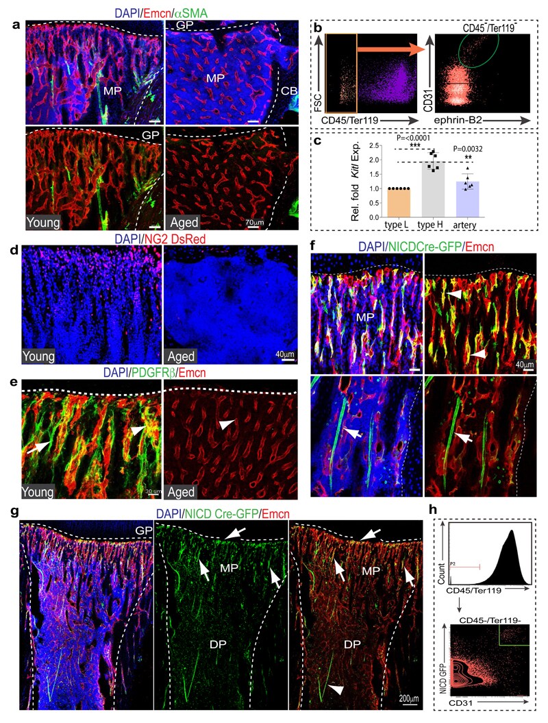 CD140b (PDGFRB) Antibody (14-1402-82)