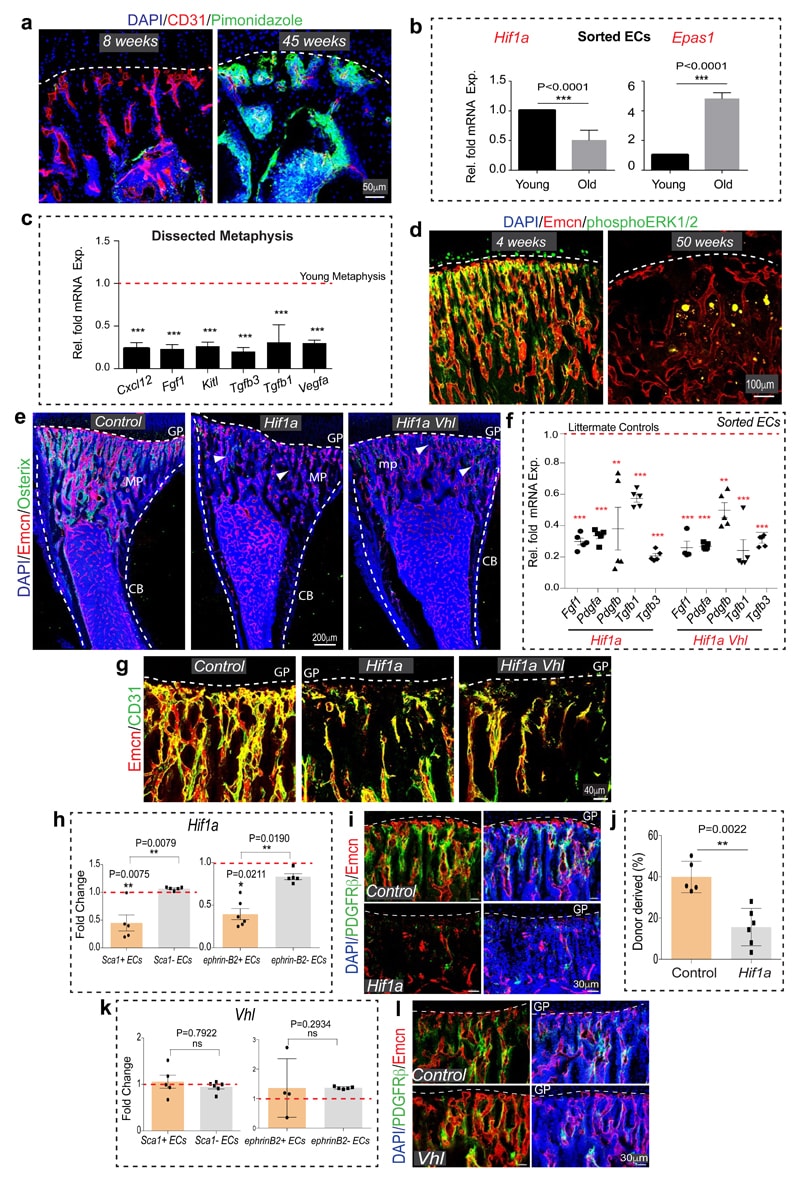 CD140b (PDGFRB) Antibody (14-1402-82)