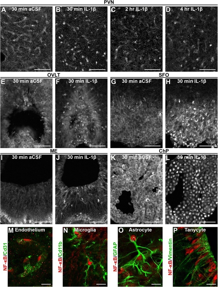 CD11b Antibody (14-0112-82)