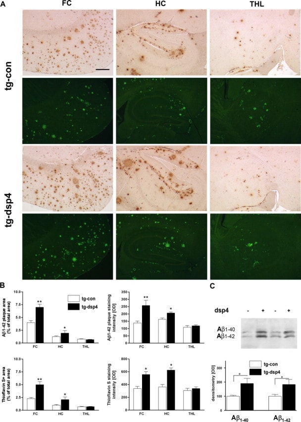 beta Amyloid (1-42) Antibody (44-344)