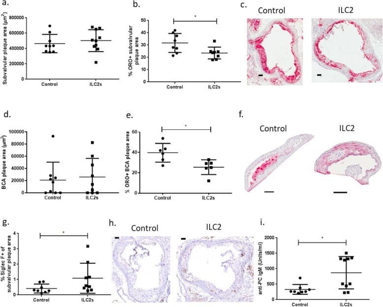 CD170 (Siglec F) Antibody (14-1702-82)