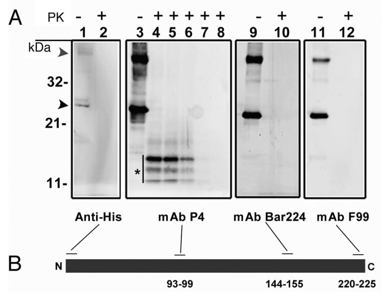 Penta-His Tag Antibody (P-21315)