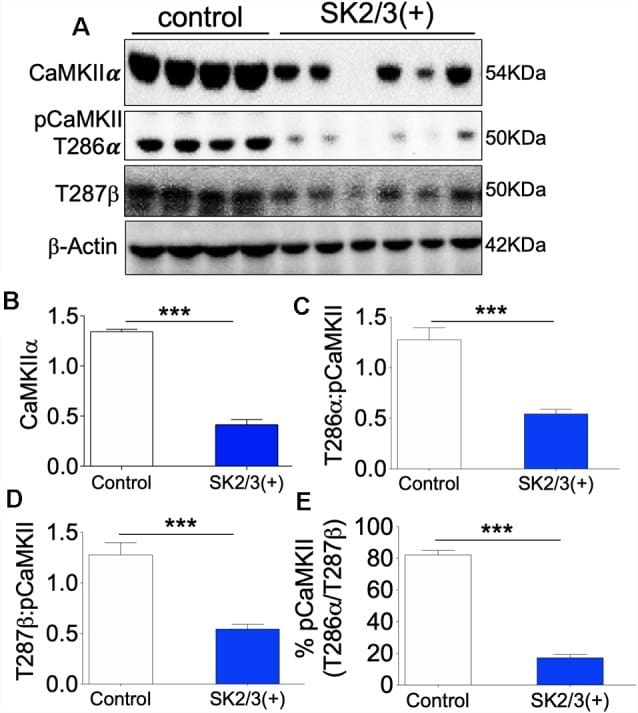 CaMKII alpha Antibody (MA1-048)