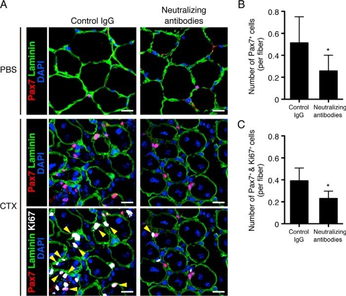 Ki-67 Antibody, eFluor® 615 (42-5698-82)
